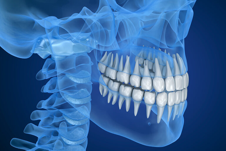 Conditions We Treat - Dental Implants In One Day and One Office